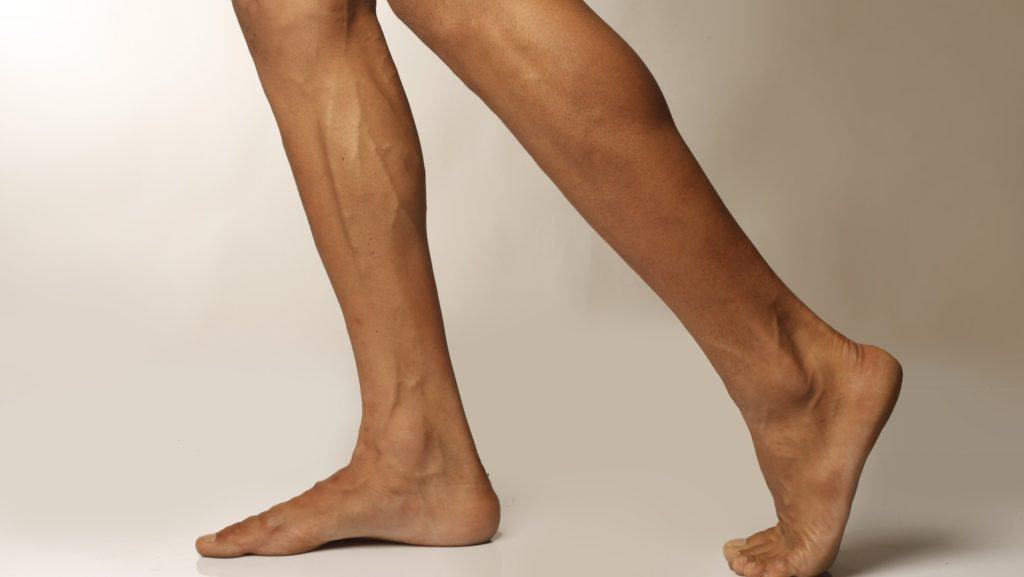 Calf Augmentation | Calf Implants Surgery